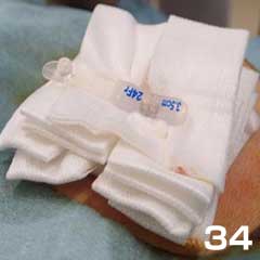 Chapter1 PEG 3.造設 1造設手技④Introducer変法｜PDNレクチャー